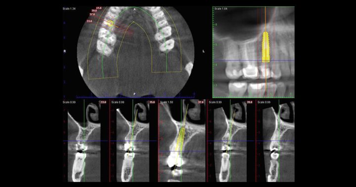 CT Scan Uses: Scenario Three | Mint Hill Dentistry