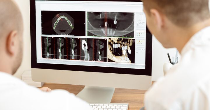 New Technology Introduction: CT Scan | Mint Hill Dentistry